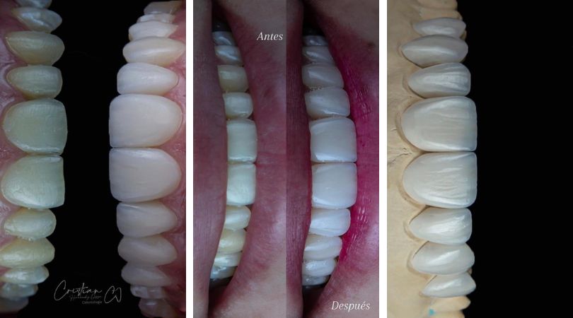 Best Dentist and Dental Implants in Colombia - Pereira - Coffee Axis Travel